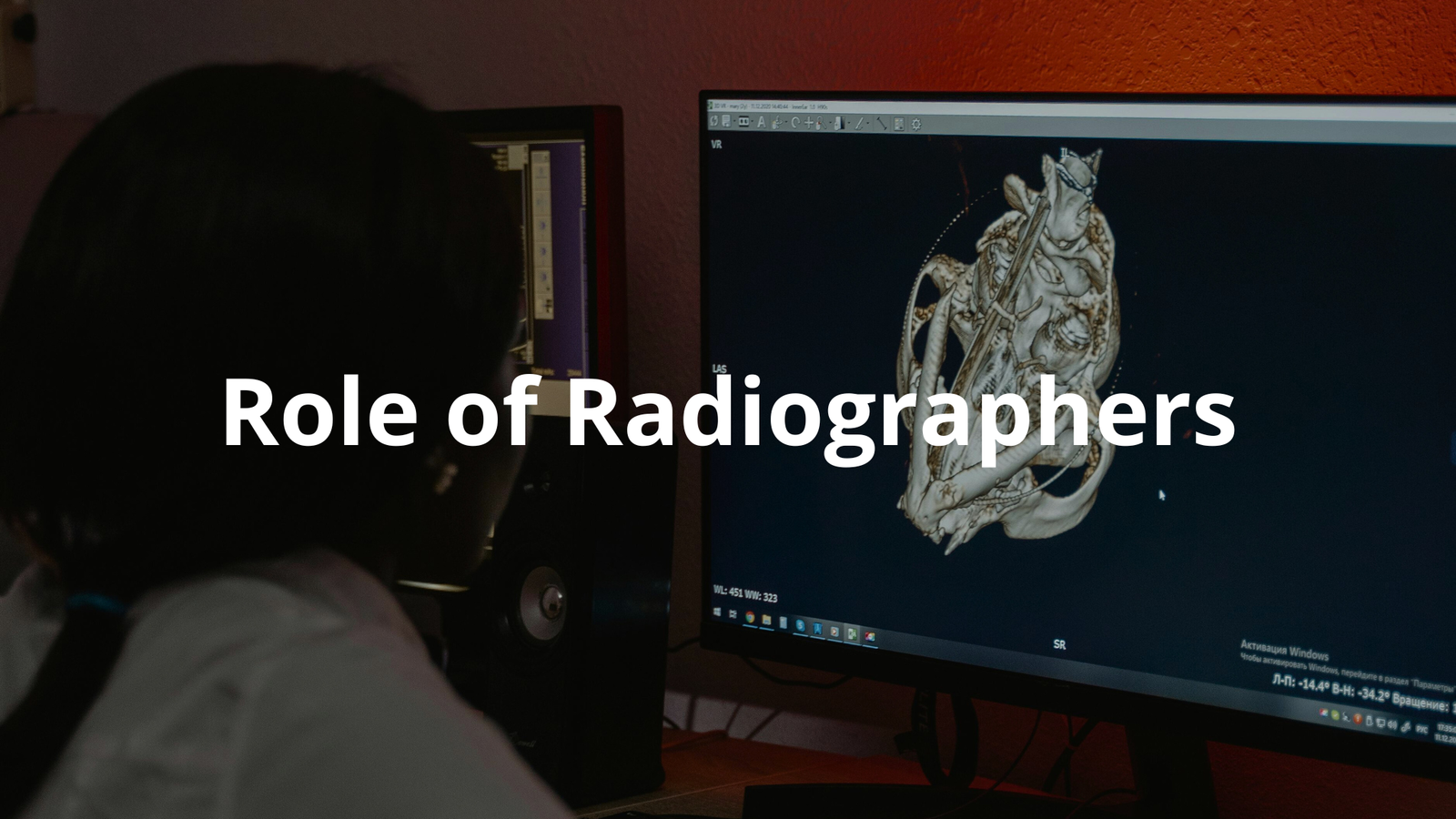 The Evolution of Imaging: A Journey Through Time